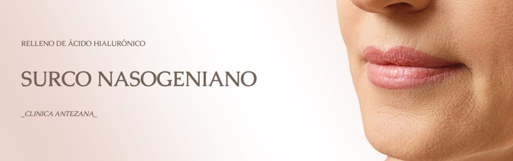 Surco Nasogeniano - Clínica Antezana